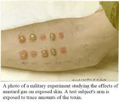 Mustard gas experiment – Historical Easter Eggs – Today in History