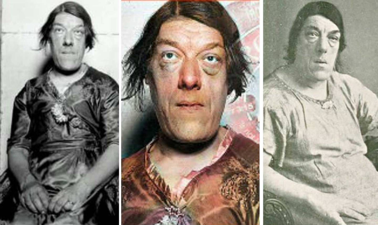 December 20, 1874 The Beautiful Story of the “Ugliest Woman in the ...